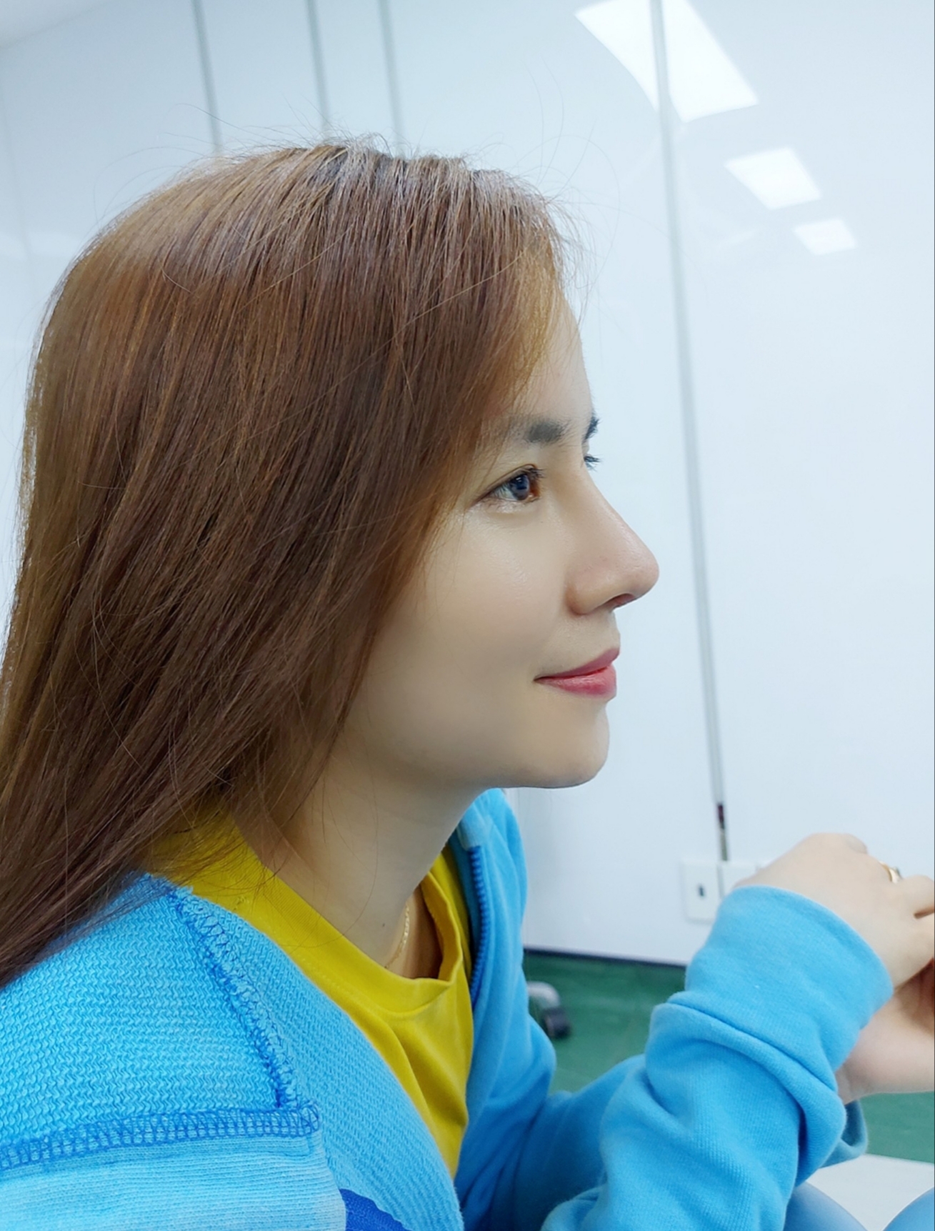 Viện thẩm mỹ Happy Nose-Dr.Đức Happy thẩm mỹ nâng mũi vi phẫu